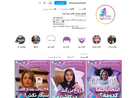 6 تا از بهترین مراکز کاشت مو تهران لوکیشن ⭐️