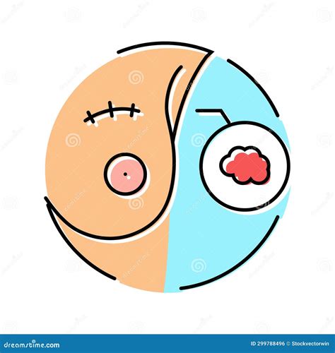 Lumpectomy Surgery Color Icon Vector Illustration Stock Vector Illustration Of Beauty Implant