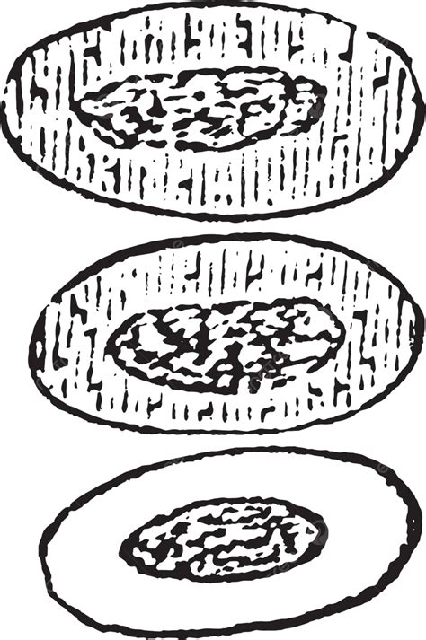 Vintage Illustration Showing The Impact Of Acetic Acid On Red Blood