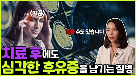 뇌진탕보다 더 위험한 뇌좌상 후유증 심한가요 후유증이 생기는 이유 YouTube