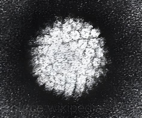 Revolutionary Advances In Hpv Linked Head And Neck Cancer Monitoring