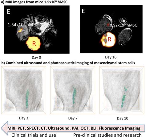 Examples Of Imaging Modalities For Rm And Stem Cell Therapy A