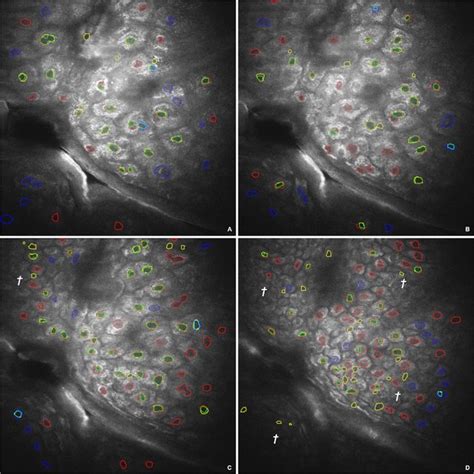 Ground Truth Comparison Ground Truth Gt And Automatic Segmentation Download Scientific