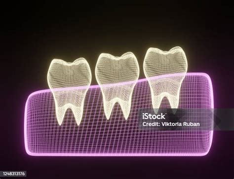 치아 와이어 프레임 메쉬 네온 그리드 어금니 연결 구조입니다 치과 의학 건강 개념 3d 렌더 0명에 대한 스톡 사진 및 기타