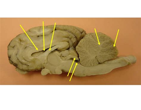 Sheep Brain Model Sagittal View Quiz