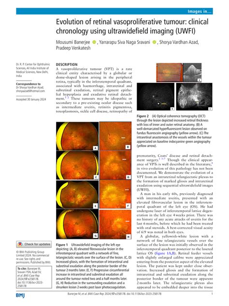 Evolution Of Retinal Vasoproliferative Tumour Clinical Chronology