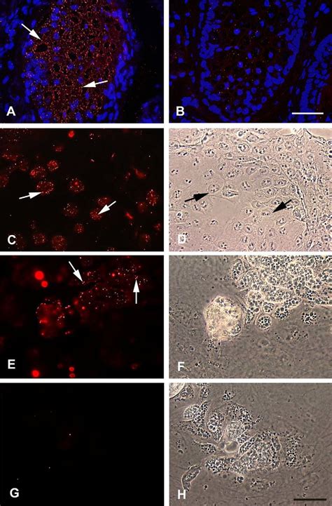 Mc5r Expression Correlates With Sebocyte Differentiation In Human Download Scientific Diagram