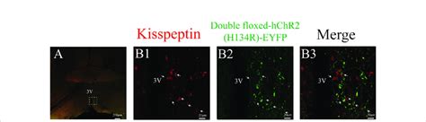 Expression Chr2 Eyfp Of Kiss1 Arc Projection Terminals In Avpv Kiss1
