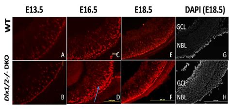 Comparing Otx2 Expression During Embryogenesis Between Wild Type And