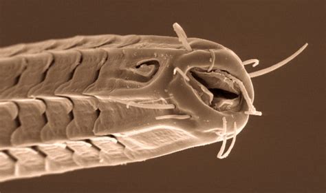 Nematode Worms In Humans