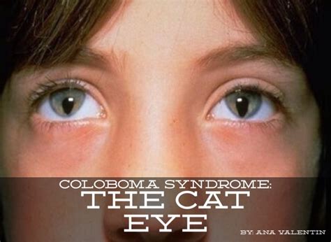 Cat With Triangle Pupil R Mildlyinteresting