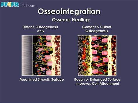 Stage I And Ii Surgery