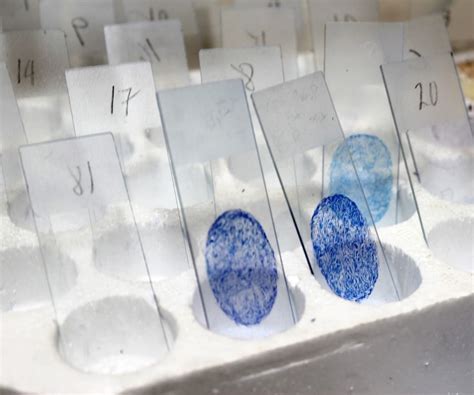 How To Make A Ziehl Neelsen Sputum Smear Slide 9 Steps With Pictures Instructables