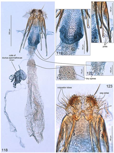 3 Female Genitalia Of Paratischeria Tubifex Diškus And Stonis Sp Nov