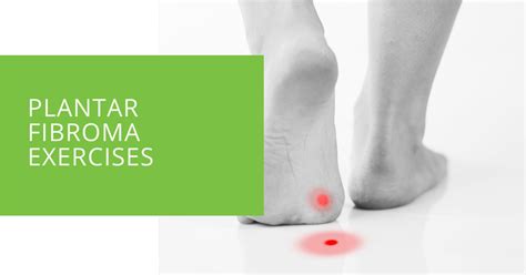 Plantar Fibroma Exercises Foot Massage For Period Cramps How To