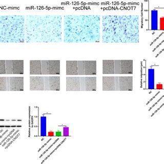 MiR 126 5p Can Directly Bind To The CNOT7 3UTR In The MCF7 Cell Line