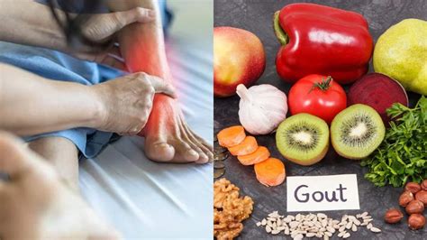Check Out 5 Foods To Lower Your Uric Acid Levels Naturally Womans Era