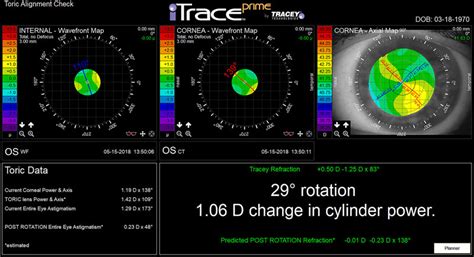 Itrace Wavefront Aberrometer Optohellas