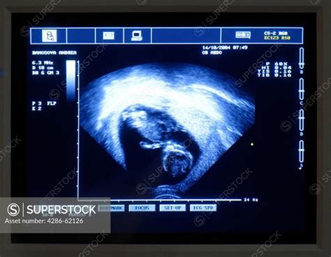 Ultrasound Investigation Ultrasonic Figure Superstock