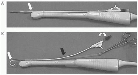 Drainage Of Abdominal Abscesses And Fluid Collections Radiology Key