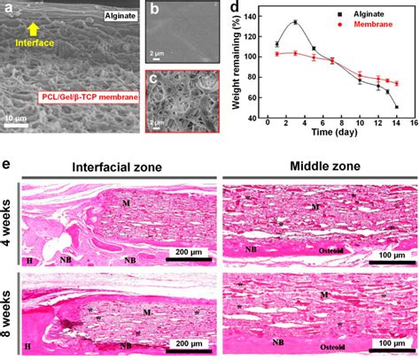 Resorbable Membranes For Guided Bone Regeneration Critical Features