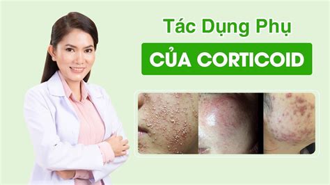 Part 3 Tác Dụng Phụ Của Coticoid Trong Sức Khỏe Và Sắc Đẹp Chuỗi