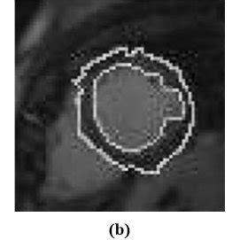 Traditional Segmentation Methods A Thresholding Automated Contours