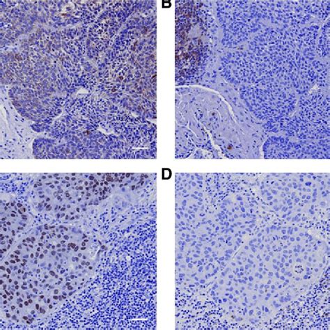 Cell Surface Cd22 Can Be Detected On Cd22 þ Daudi Cells But Not On
