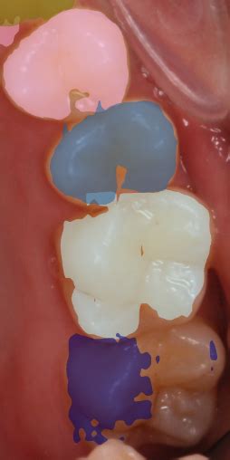 Mask Decoder Finetuning · Issue 49 · Chaoningzhangmobilesam · Github