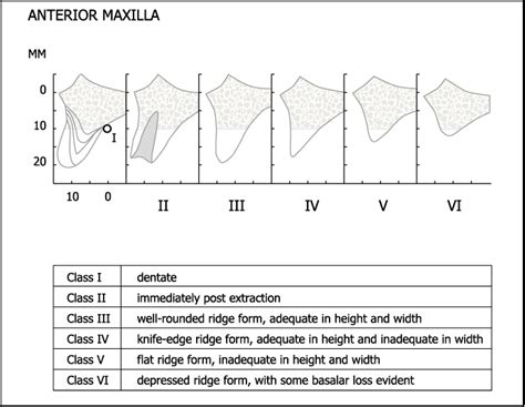 6 Anatomical Variations Pocket Dentistry