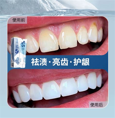 5 羟基磷灰石美白牙膏呵护口腔去黄去渍清新口气厂家批发100g 阿里巴巴