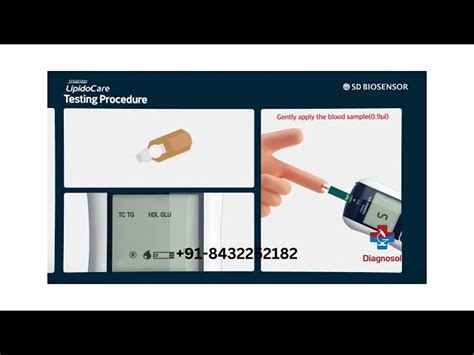Lipid Profile Meter Sd Lipidocare Test Strips Lipid Profile Trader