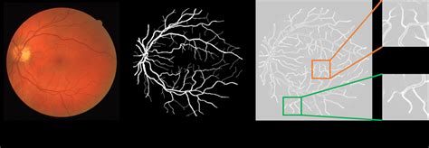 An Example Of The Proposed Spatial Activation The Attention Maps Is Download Scientific