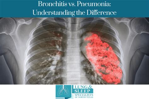 Bronchitis Vs Pneumonia Understanding The Difference Lung And Sleep Specialists Of North Texas