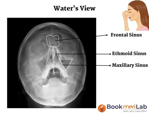 Exploded View X Ray Views