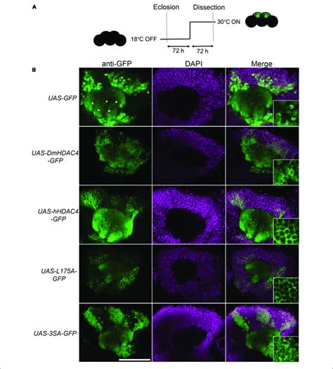 Expression And Subcellular Localization Of Gfp Tagged Hdac4