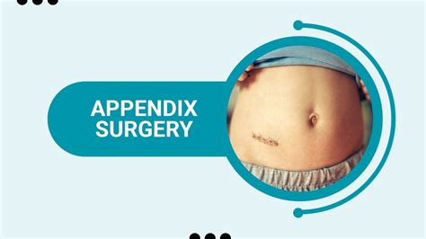 Appendix Surgery