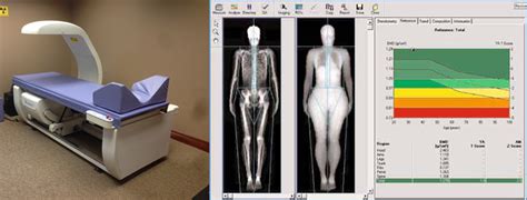 Dexa Scan Dxa Scan Measure Bone Density And Body Fat Osteoporosis