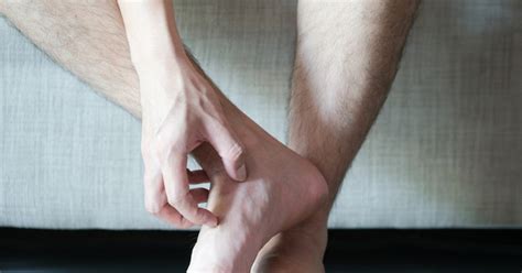 밤만 되면 가려운 발 원인과 대처법