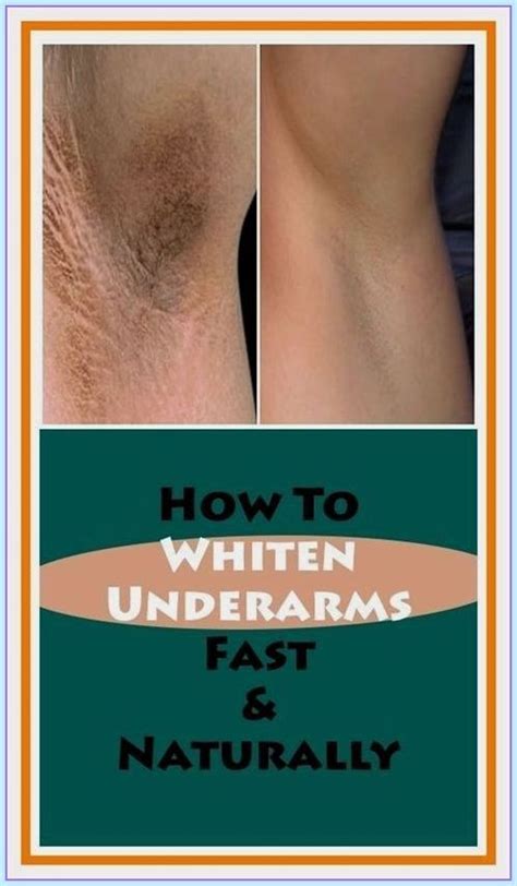 How To Whiten Underarms Fast And Naturally Lynda Sowers Artofit