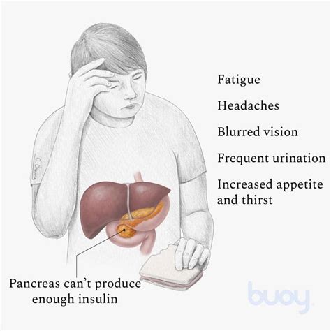 Type 1 Diabetes Symptoms