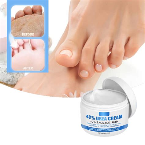 Pumice Stone For Feet Hand Peel Pedicure Brush For Feet Heel Peel