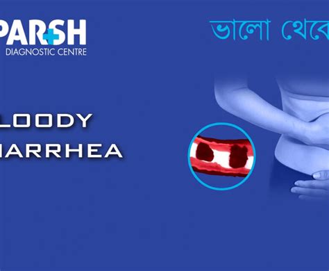 Lymphoma Sparsh Diagnostic Center