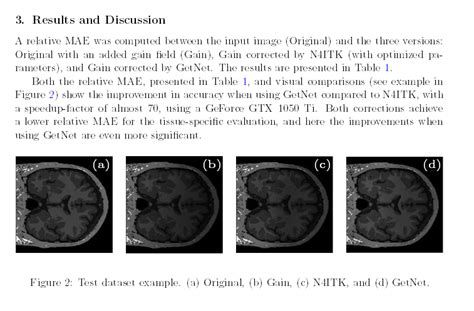 Archived Post A Generalized Network For Mri Intensity Normalization