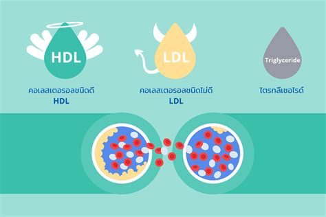 รู้จัก คอเลสเตอรอล Ldl Hdl ไตรกลีเซอไรด์ ต่างกันอย่างไร Primocare