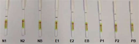 Samples E Eb N Nb P And Pb For The Lateral Flow Strips With