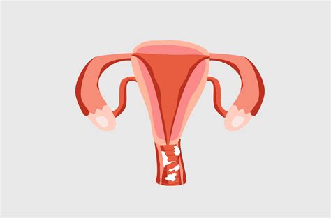 Nice Cks Vaginal Thrush Pregnancy