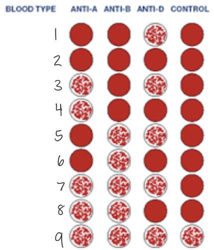 Biol 111 Lab Final Exam Extra Flashcards Quizlet