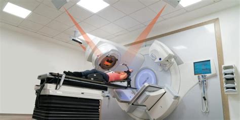 Alignrt And Dibh For Reduced Radiation Toxicity Vision Rt