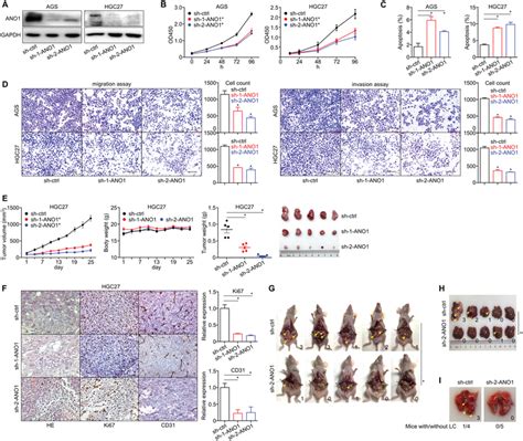 Ano1 Knockdown Inhibits The Malignant Progression Of Gc A